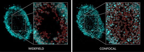 Next Generation Cytation: Advanced and automated spinning disk confocal ...